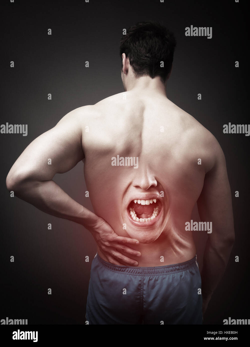 Back Pain Concept. Human Spine Injury Stock Photo - Alamy