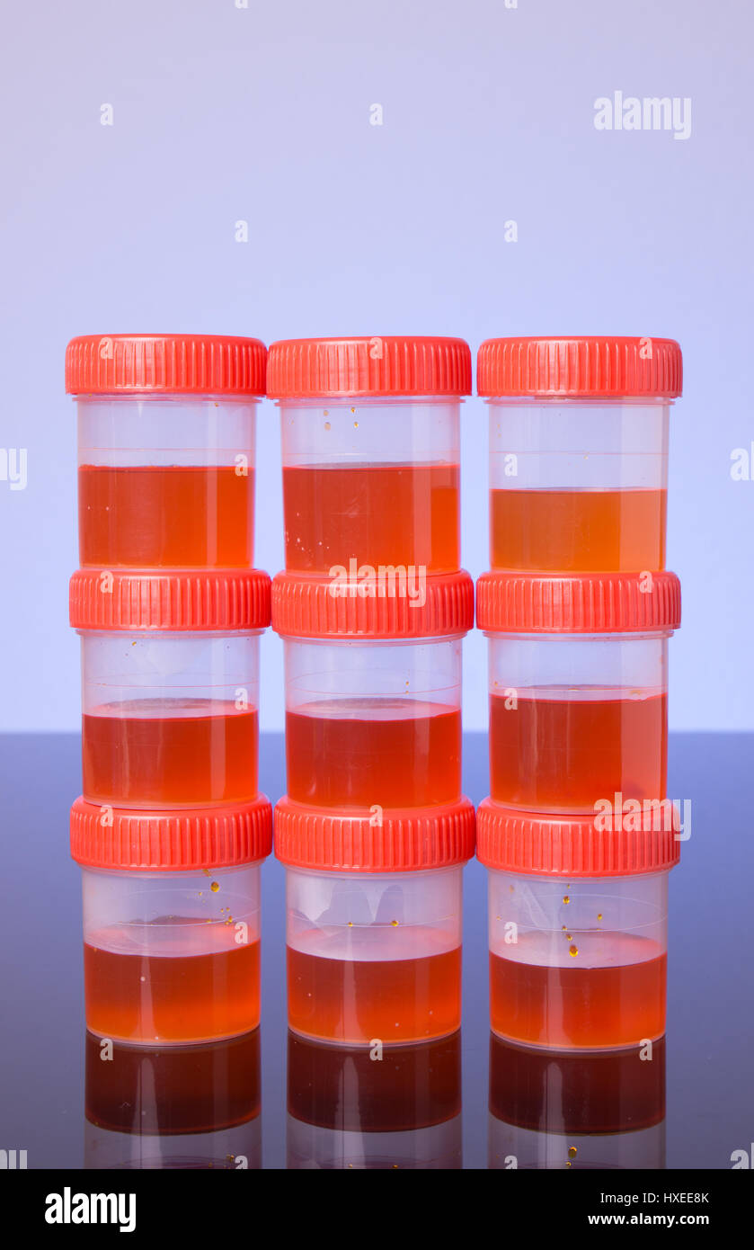 Pile of urine sample tube isolated on a shiny black blue background ...