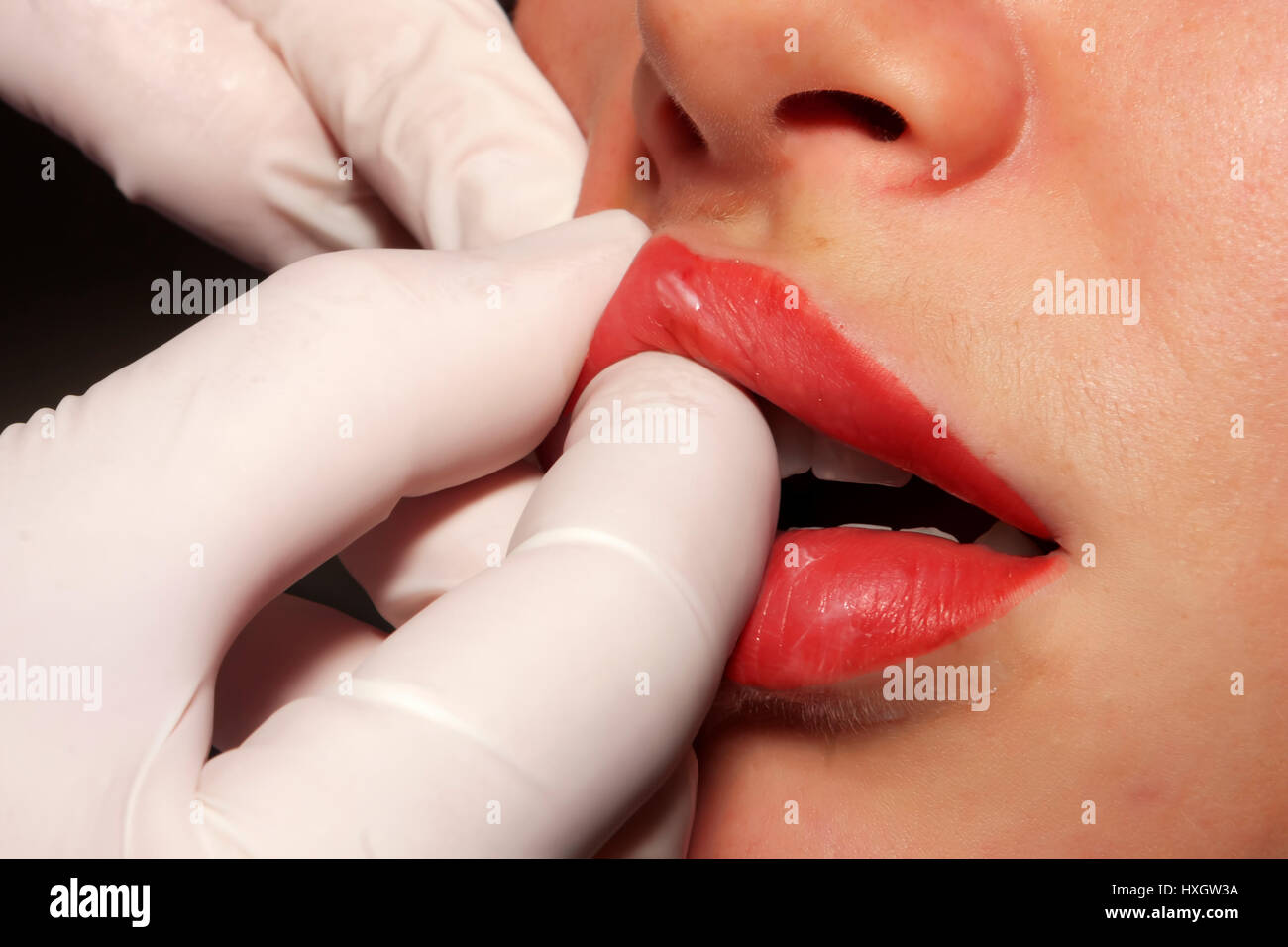 Contour plastic: Lips massage after the contour plastic Stock Photo - Alamy