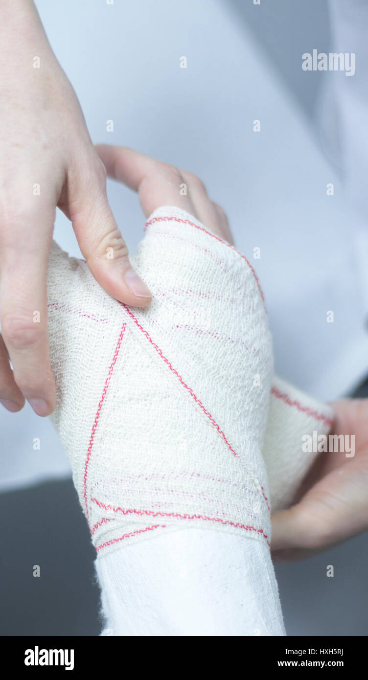 Doctor applying a plaster cast and bandages to patient forearm and ...