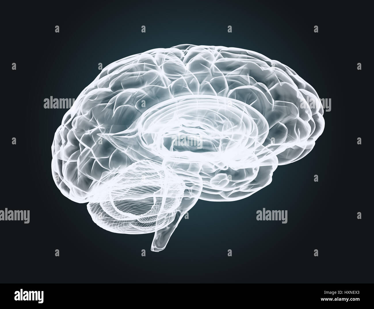 Brain scan X-ray on dark background Stock Photo - Alamy
