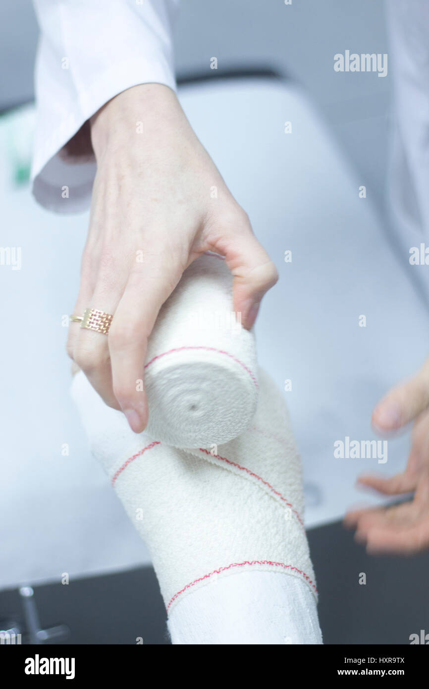 Doctor applying a plaster cast and bandages to patient forearm and ...
