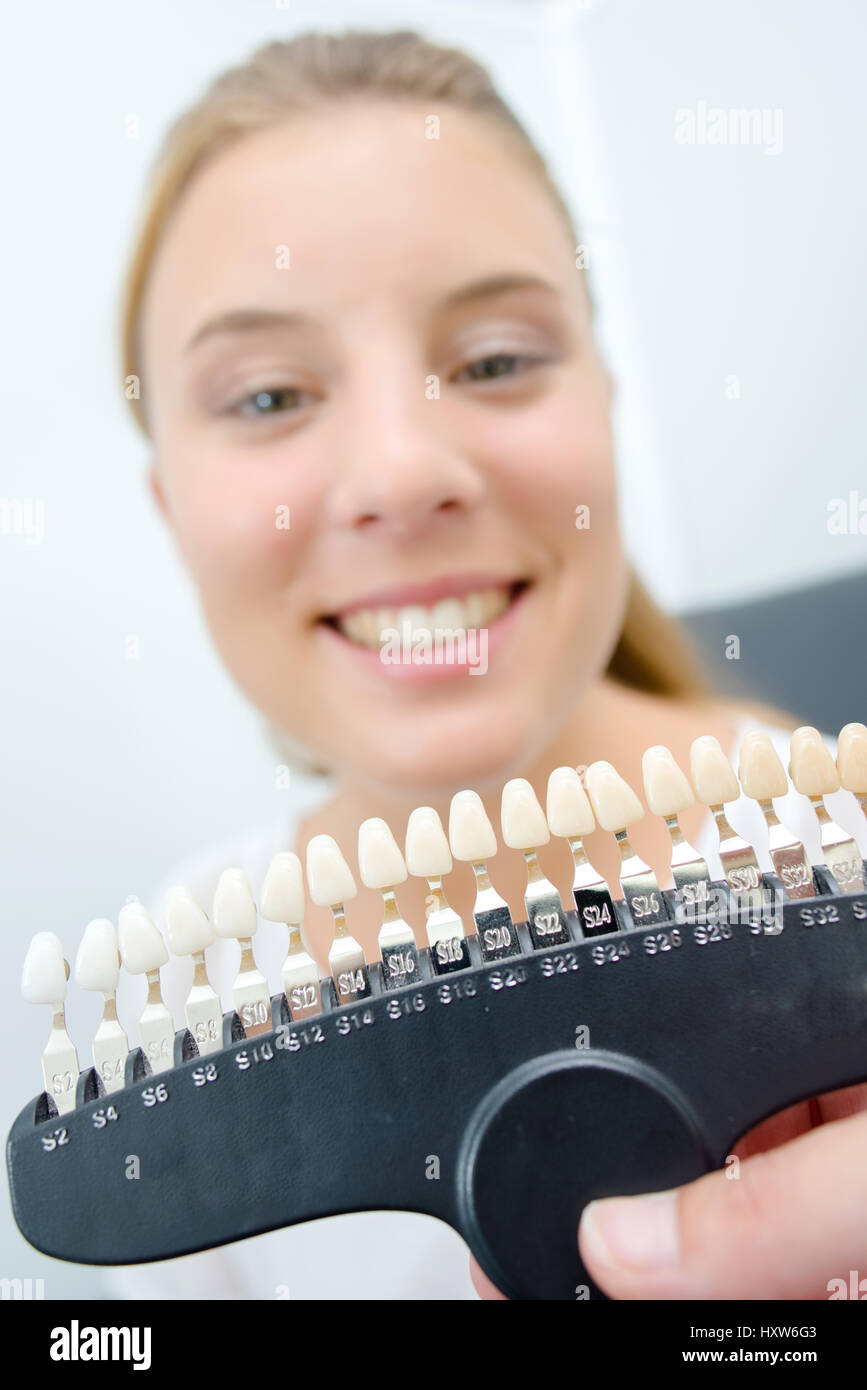Lady showing teeth to match with color samples Stock Photo - Alamy