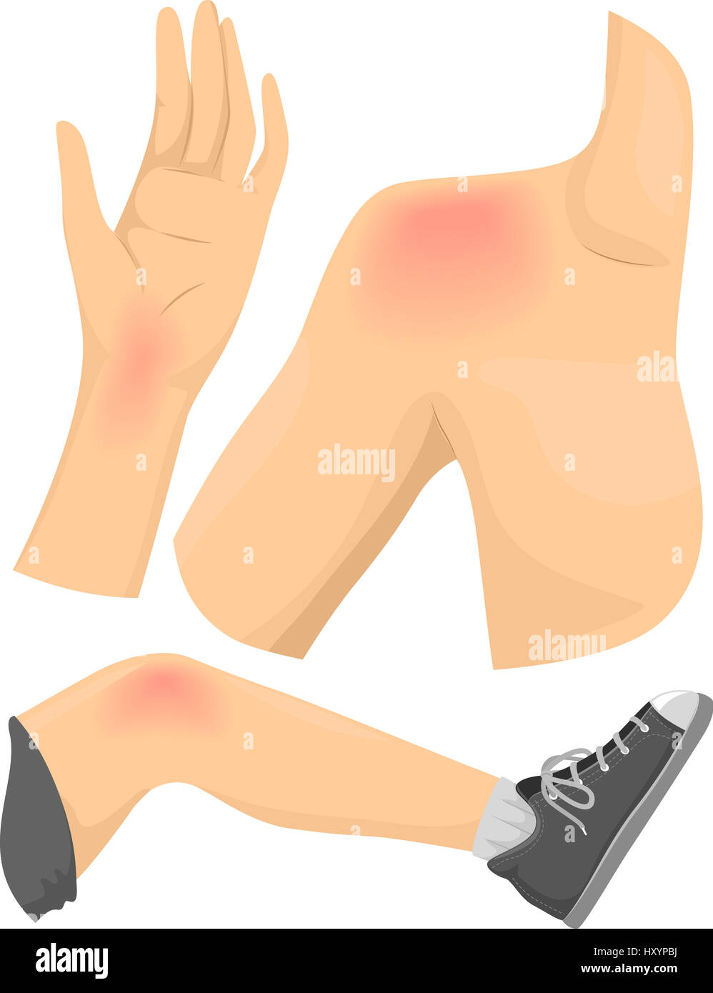 Illustration of Elements Featuring Common Types of Body Pain Stock ...