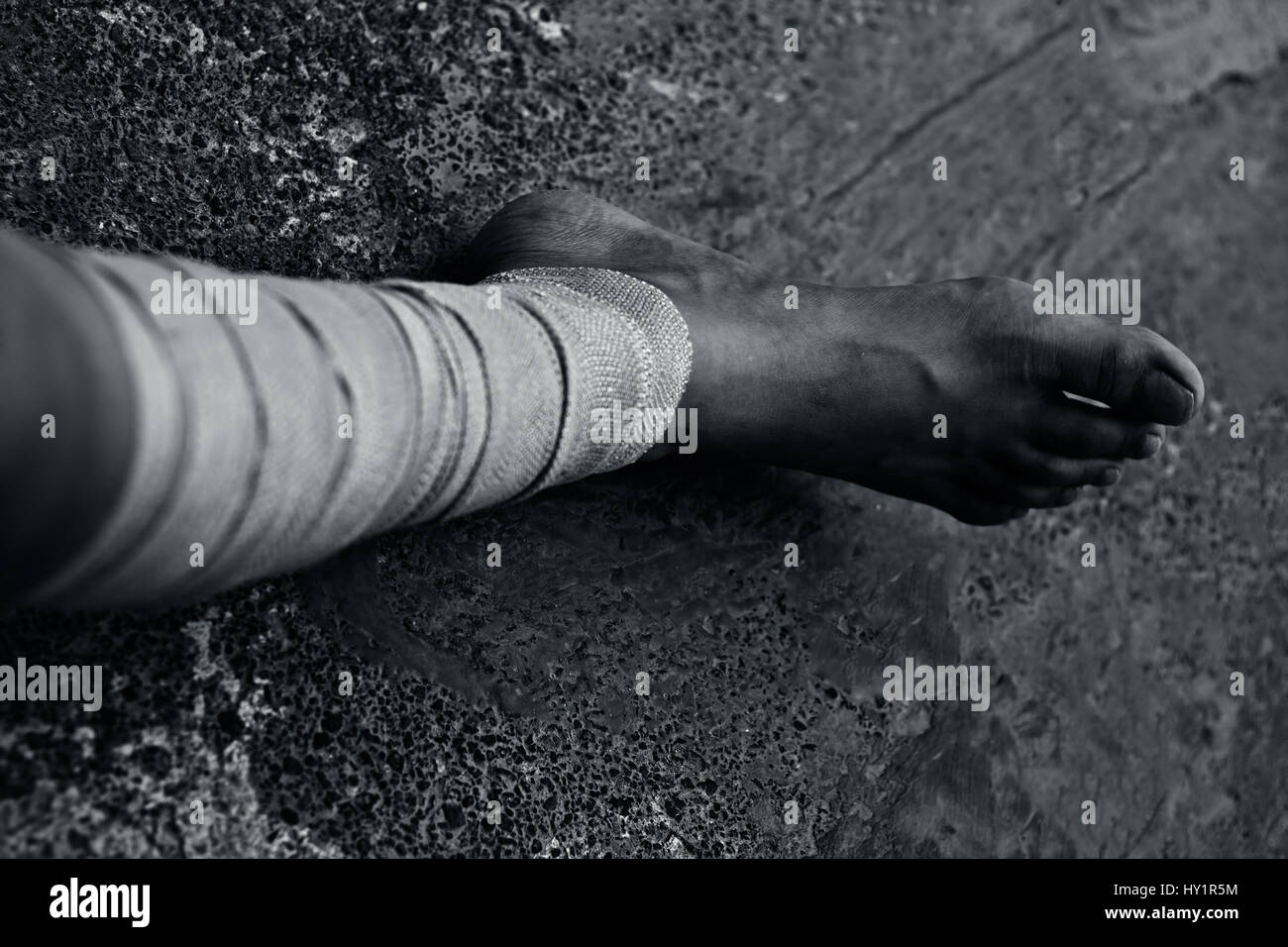 Human leg covered with a bandage or plaster Stock Photo - Alamy