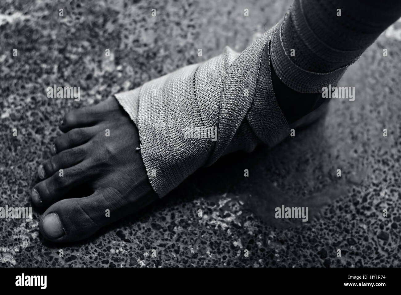 Human leg covered with a bandage or plaster Stock Photo - Alamy