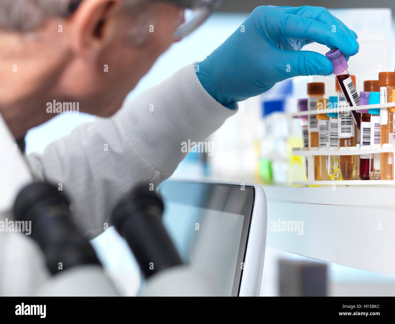 MODEL RELEASED. Scientist preparing human medical samples for testing ...