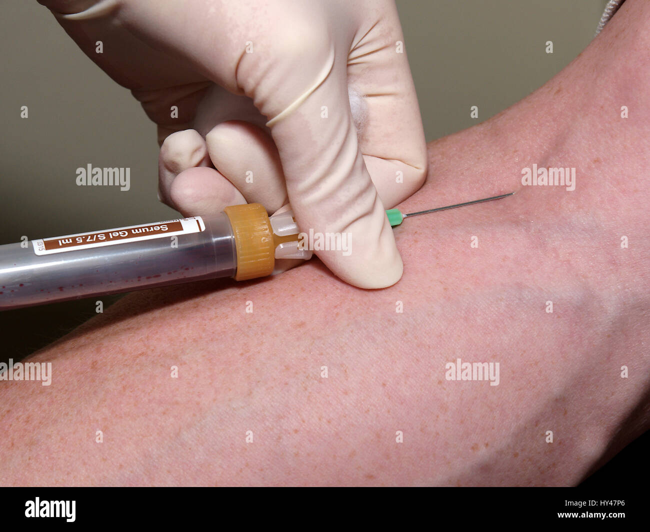 Cannula blood hi-res stock photography and images - Alamy