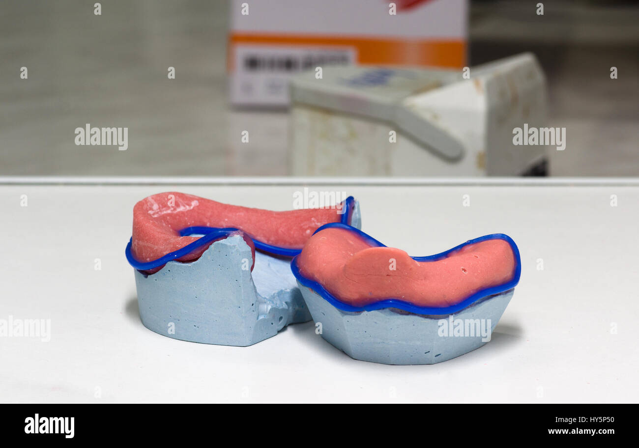 Artificial dentures in the manufacturing steps in the dental lab Stock ...
