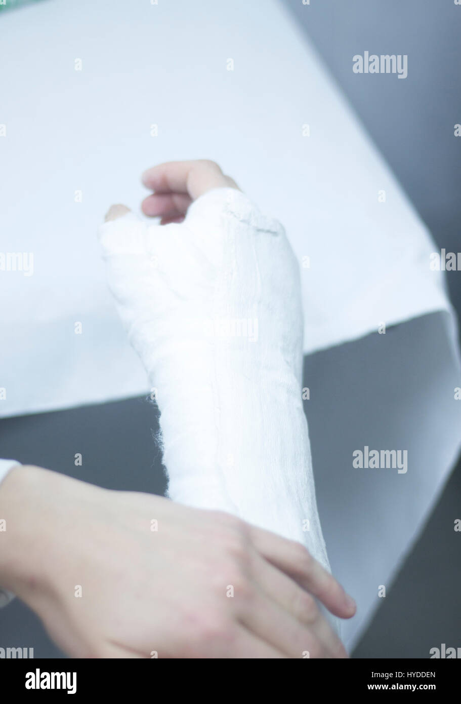 Doctor applying a plaster cast and bandages to patient forearm and ...