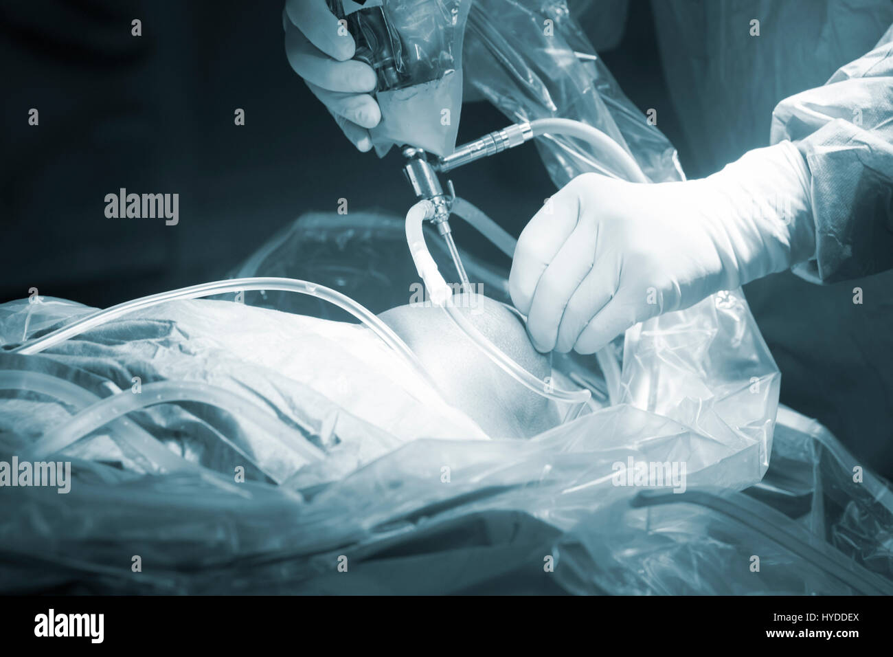 Knee keyhole surgery hospital arthroscopy operation medical procedure ...