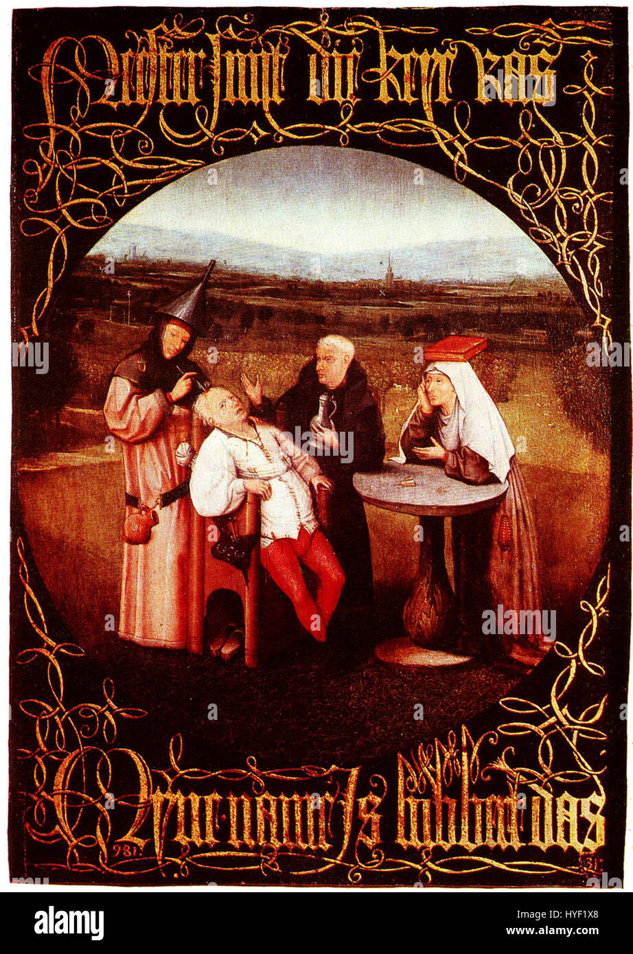Trepanation in medieval times was a medical procedure in which a hole ...