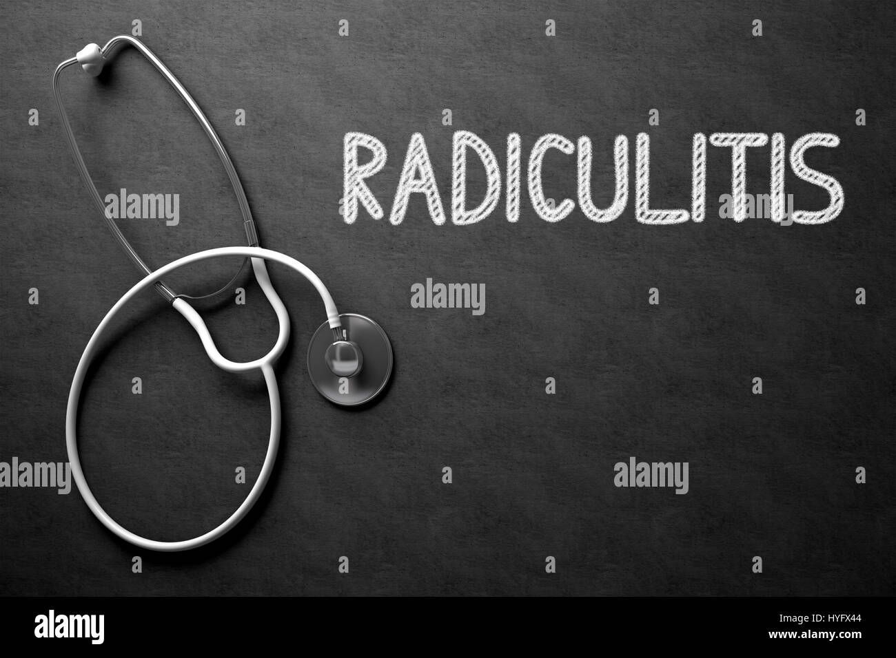 Lumbar radiculopathy hi-res stock photography and images - Alamy