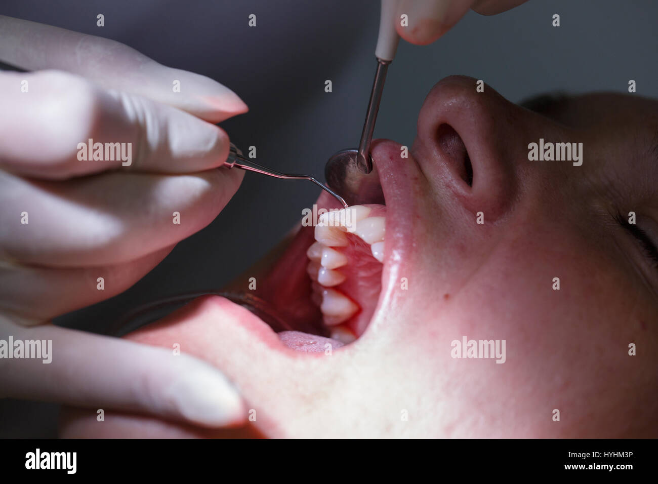 Periodontal probe hi-res stock photography and images - Alamy
