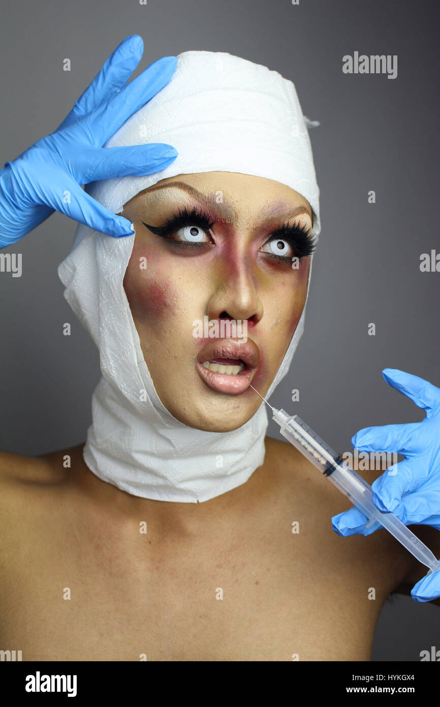 Botched surgery hi-res stock photography and images - Alamy