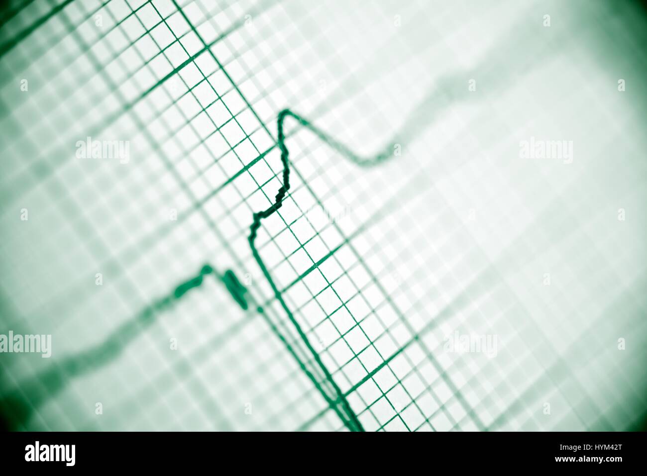 Close up of an electrocardiogram in paper form Stock Photo - Alamy
