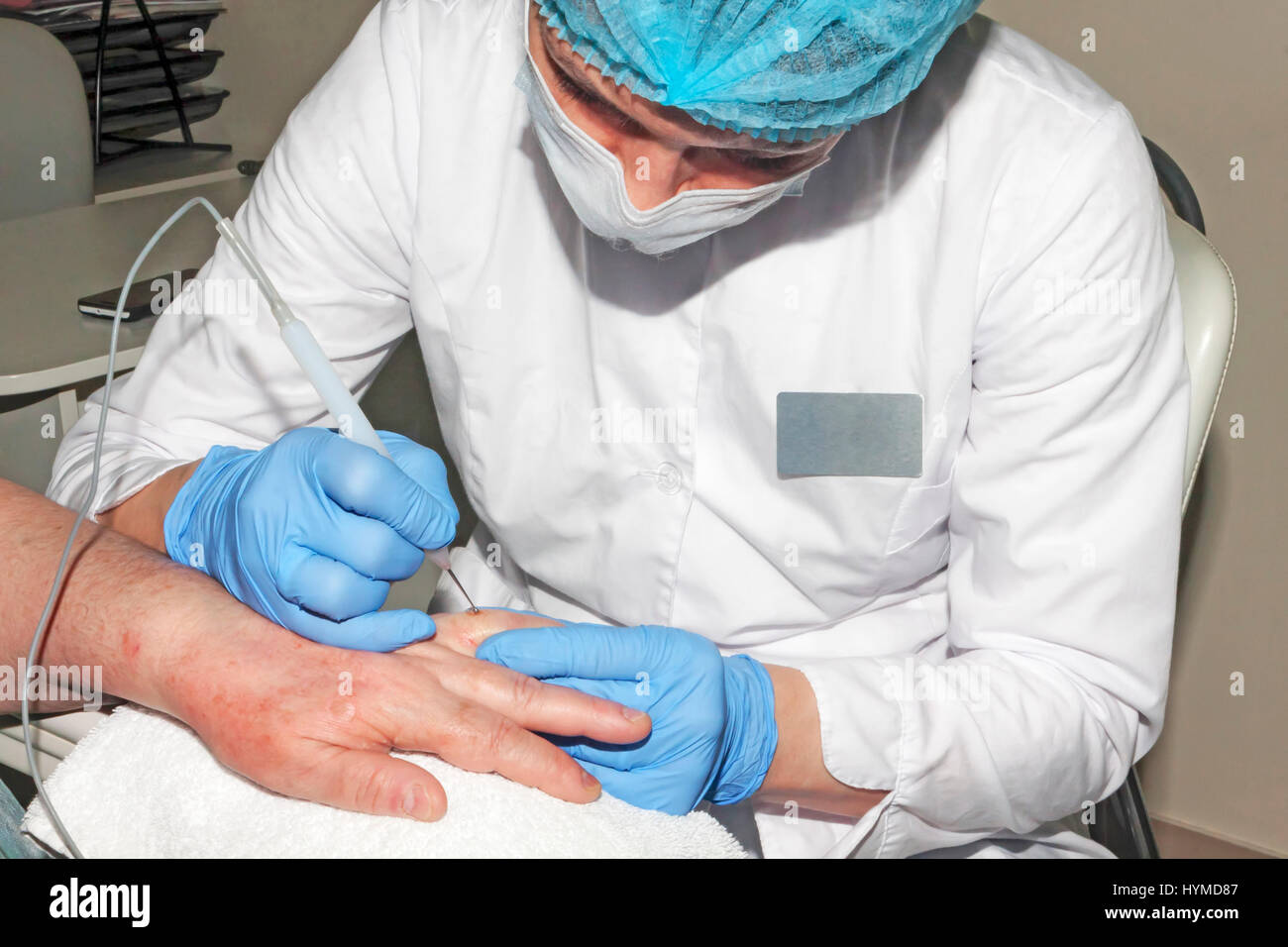 Microsurgery: Dermatologist surgeon removes skin diseases Stock Photo ...