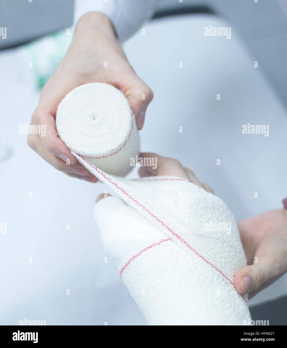 Doctor applying a plaster cast and bandages to patient forearm and ...
