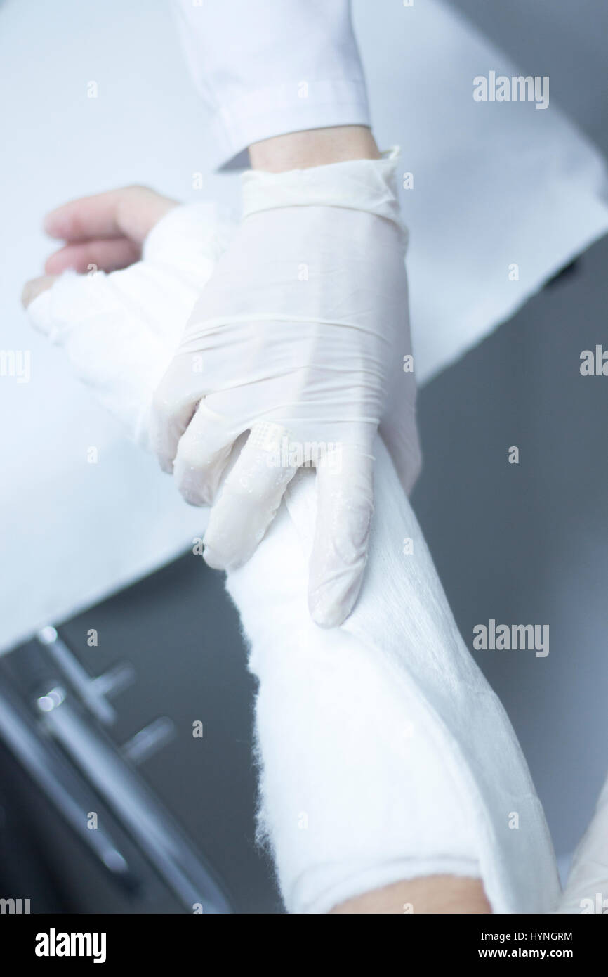 Doctor applying a plaster cast and bandages to patient forearm and ...