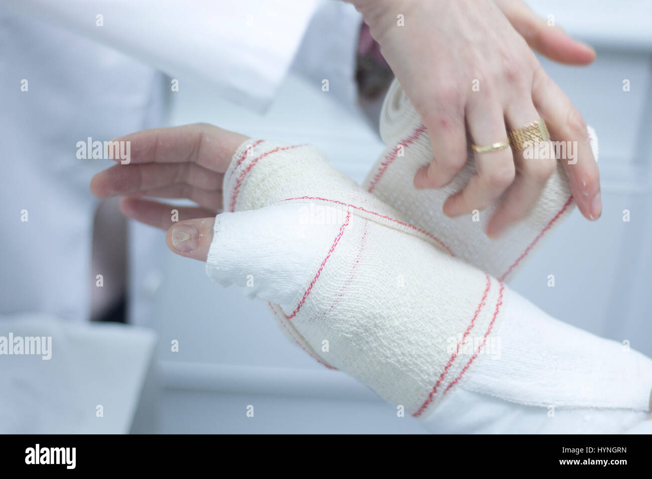 Doctor applying a plaster cast and bandages to patient forearm and ...