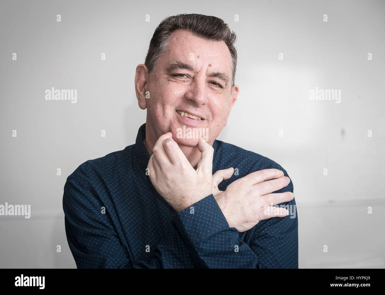 The Uks First Double Hand Transplant Patient Chris King At Leeds