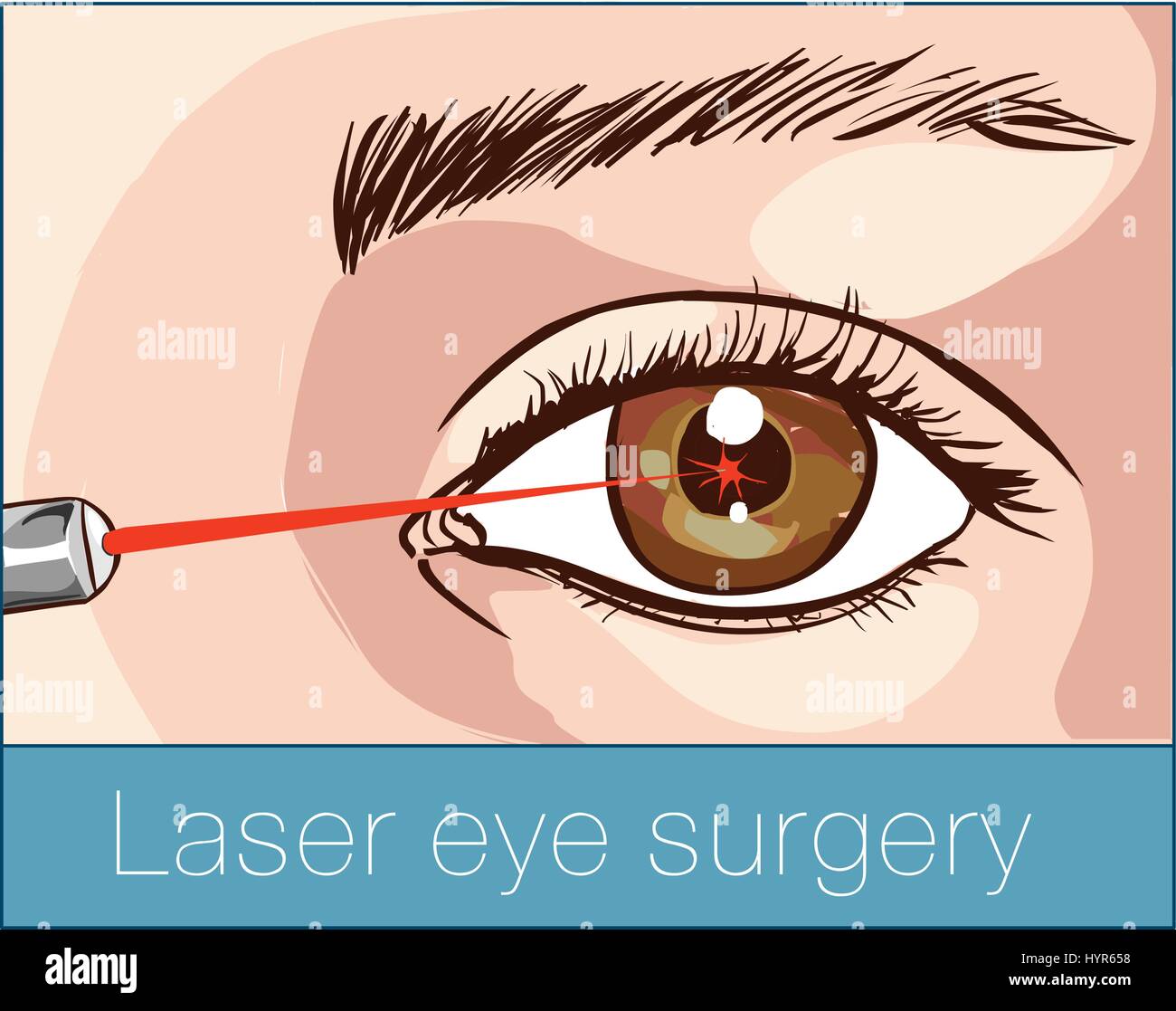 Inject in eye Stock Vector Images - Alamy