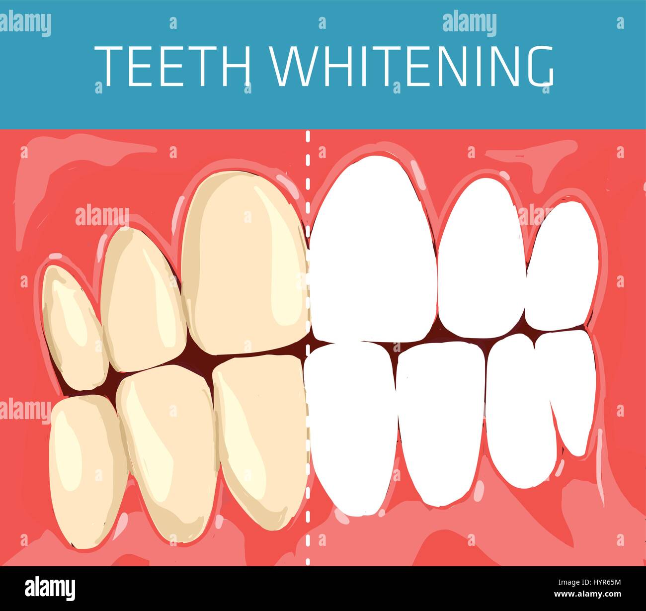 Dental visual guide hi-res stock photography and images - Alamy