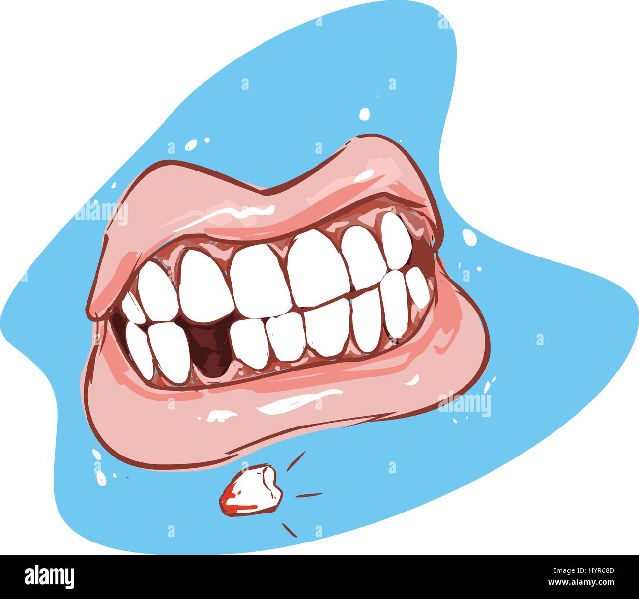 Broken Tooth Clip Art