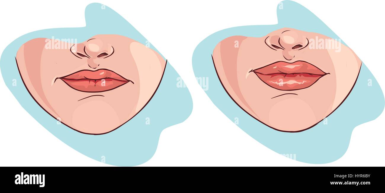 Blue backround Vector illustration of a lip filler Stock Vector Image ...