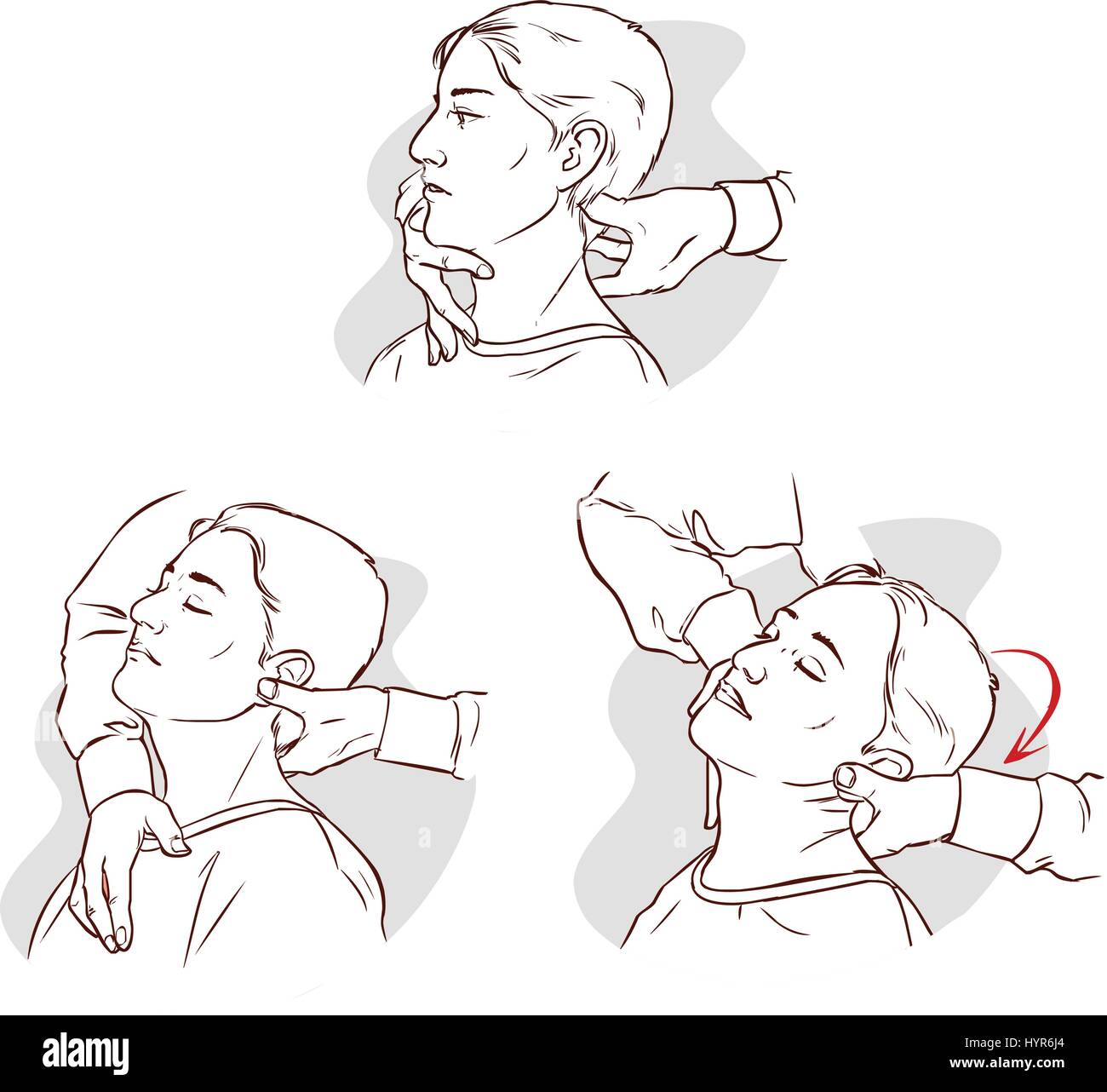 Vector illustration of a Gonstead Chiropractic for acute neck pain ...