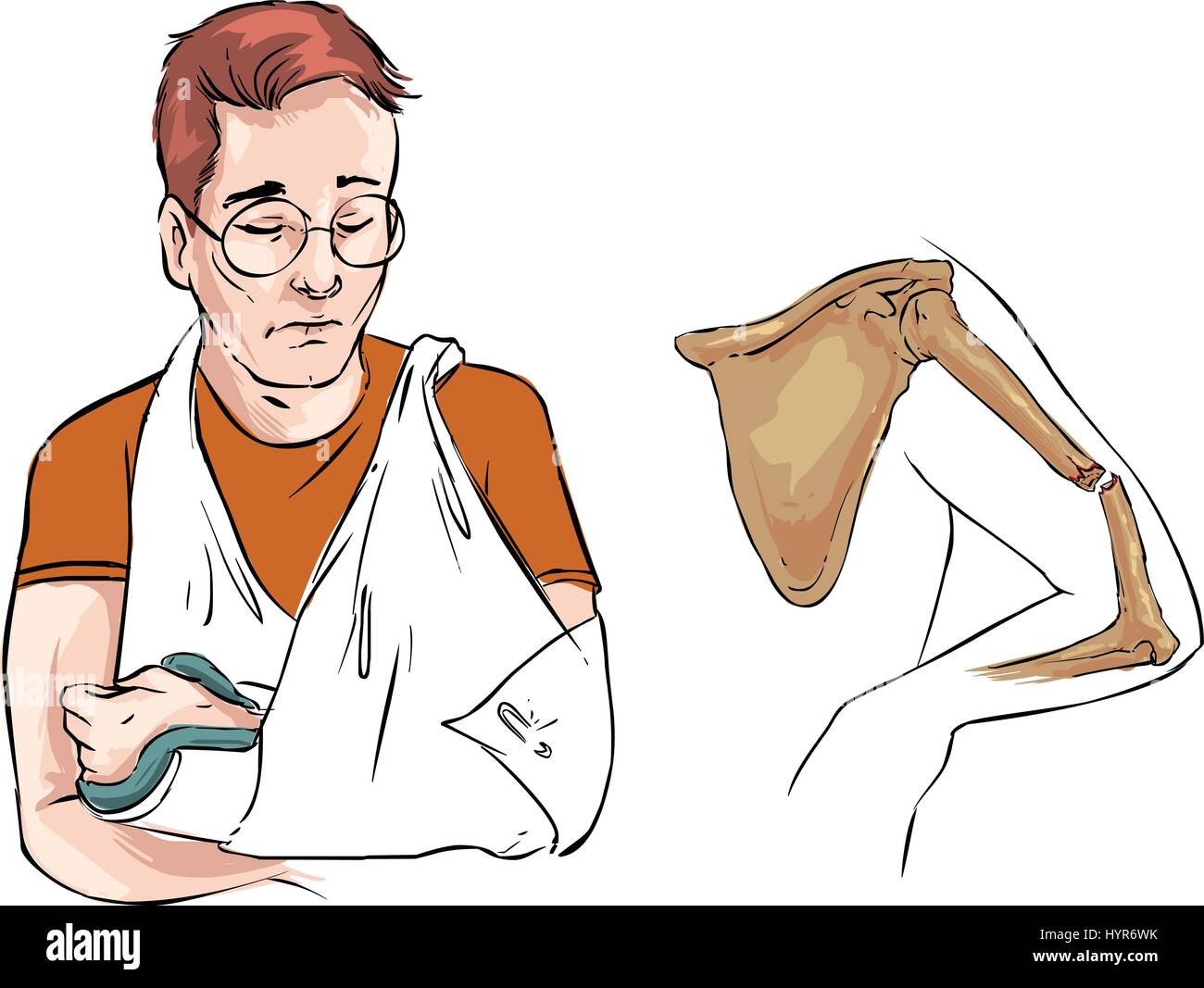 vector illustration of a guy with an arm fracture Stock Vector Image ...