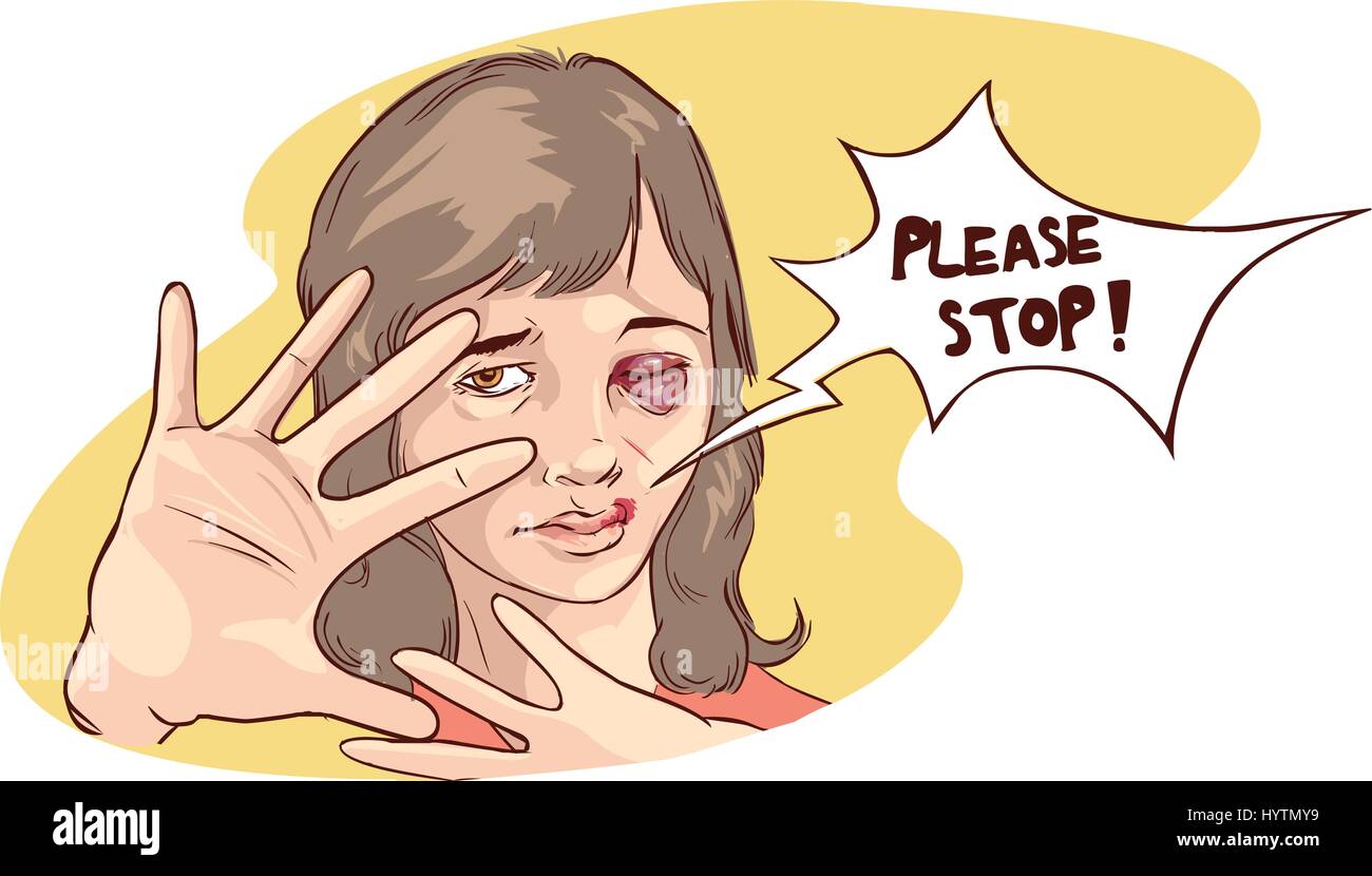 Battered woman black eye sad hi-res stock photography and images - Alamy