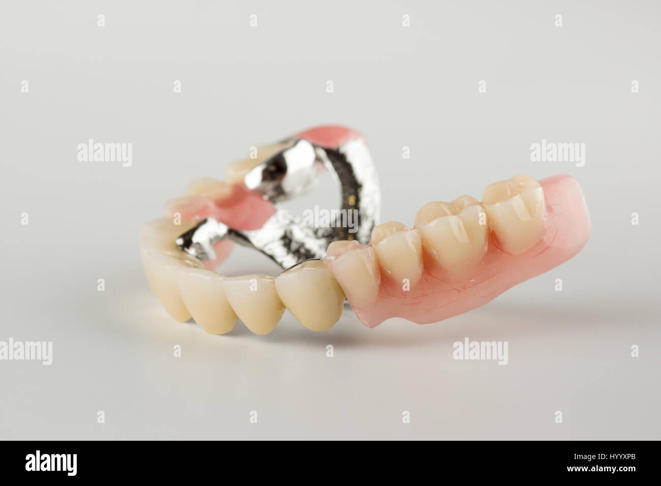 Clasp prosthesis with lock fixation on a white background Stock Photo ...