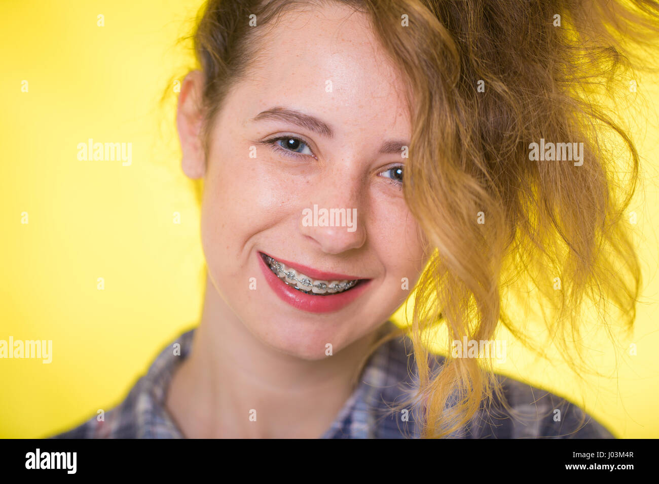 Young girl in a plaid shirt on yellow background showing her dental ...