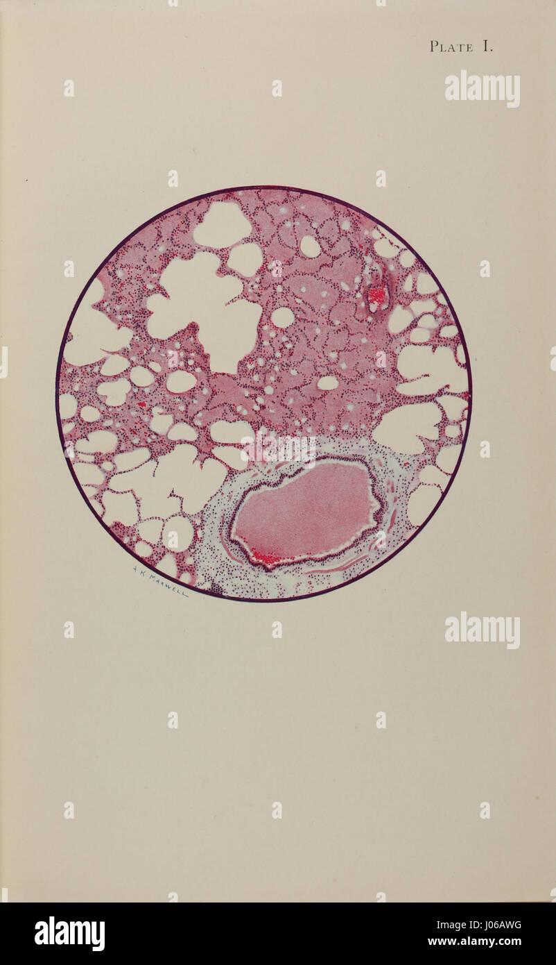 This illustration from 'An Atlas of Gas Poisoning' by the American Red ...