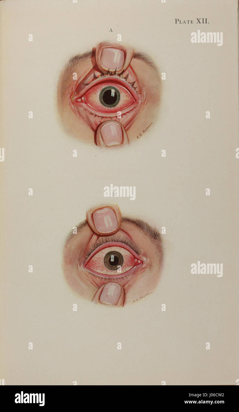 'An Atlas of Gas Poisoning' by the American Red Cross and Medical ...
