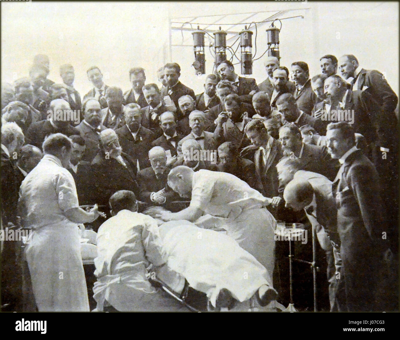 'Opération Craniectomie Août 1900' is a historical medical illustration ...