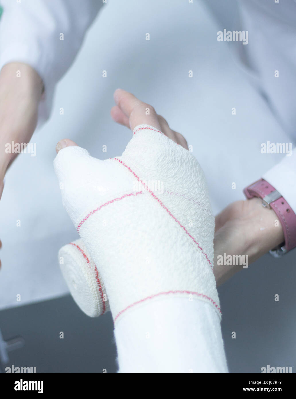 Doctor applying a plaster cast and bandages to patient forearm and ...
