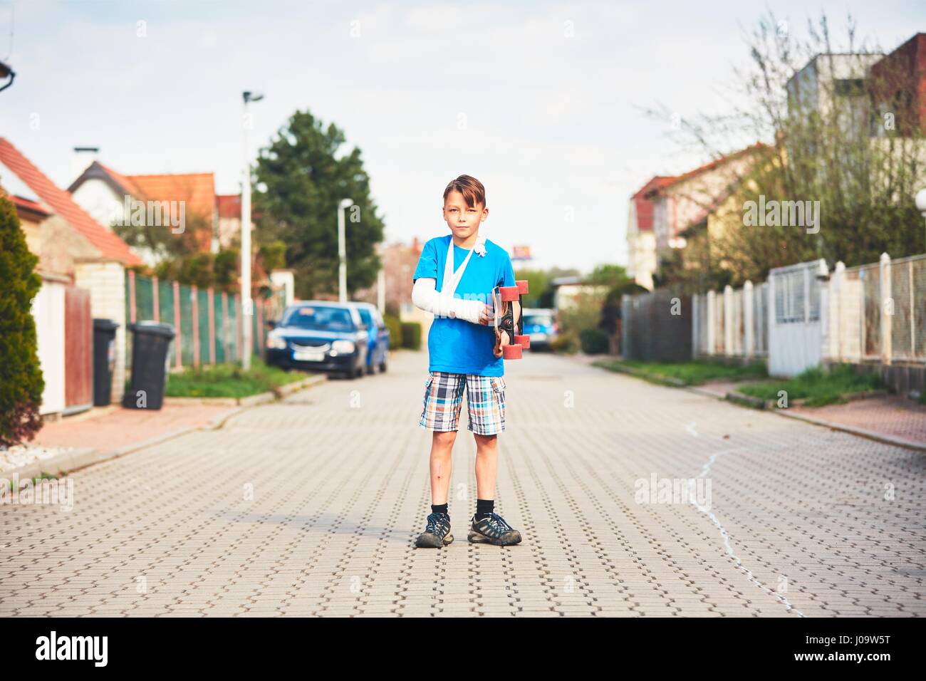 Mischievous boy with broken hand injured after accident on skateboard ...