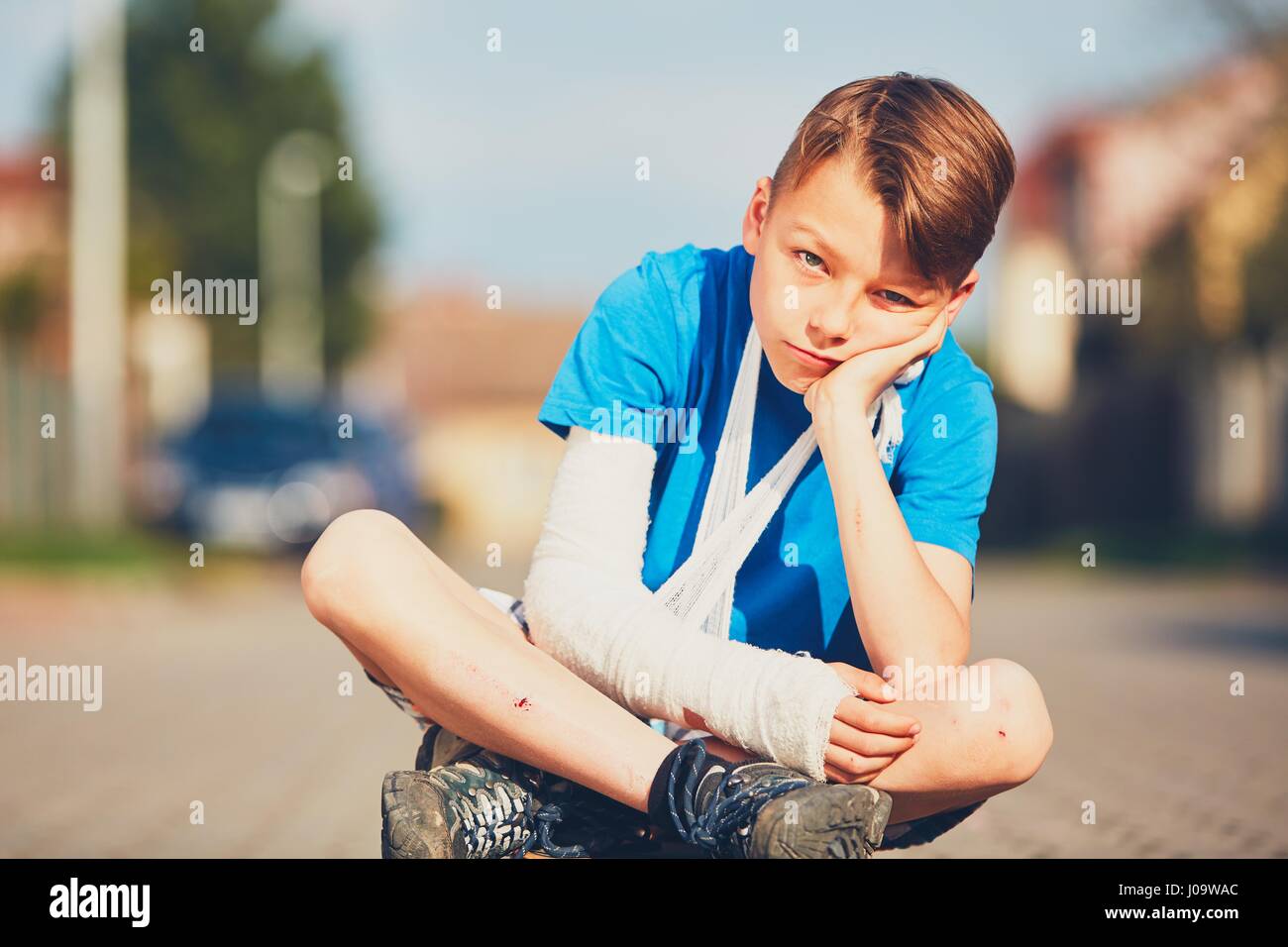 Face after accident hi-res stock photography and images - Alamy