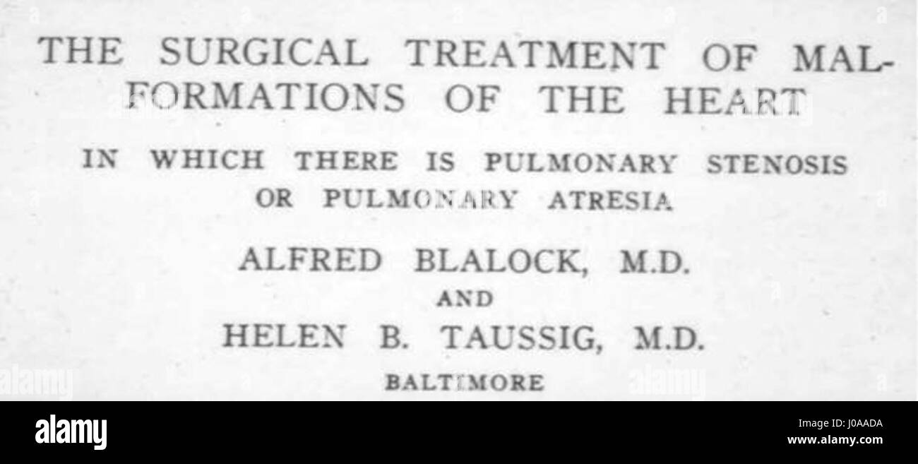 This work depicts Dr. Blalock and Dr. Taussig, two medical pioneers ...