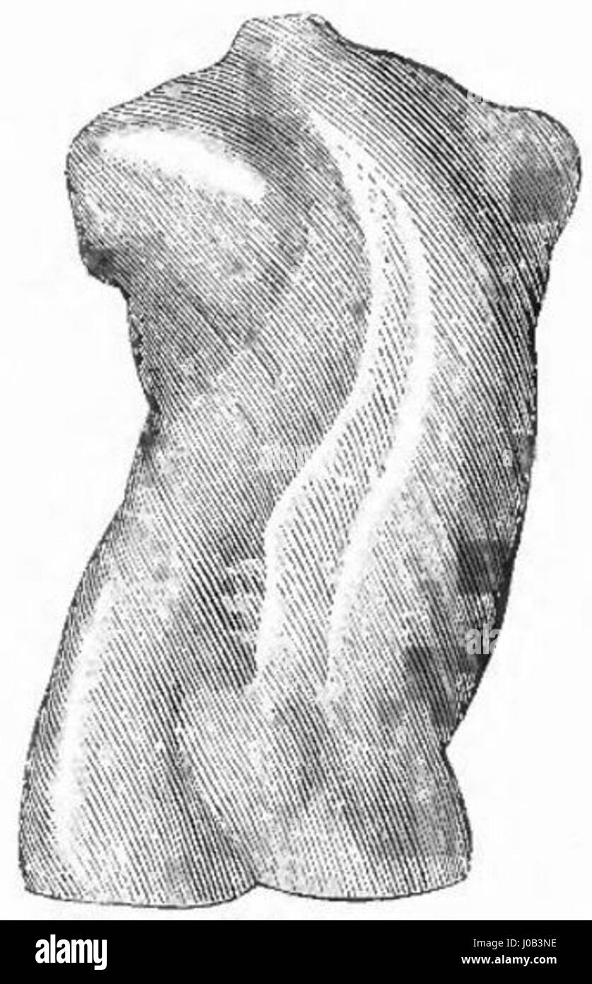 Catalogue de corsets de Rainal Frères Fig 133 Stock Photo - Alamy