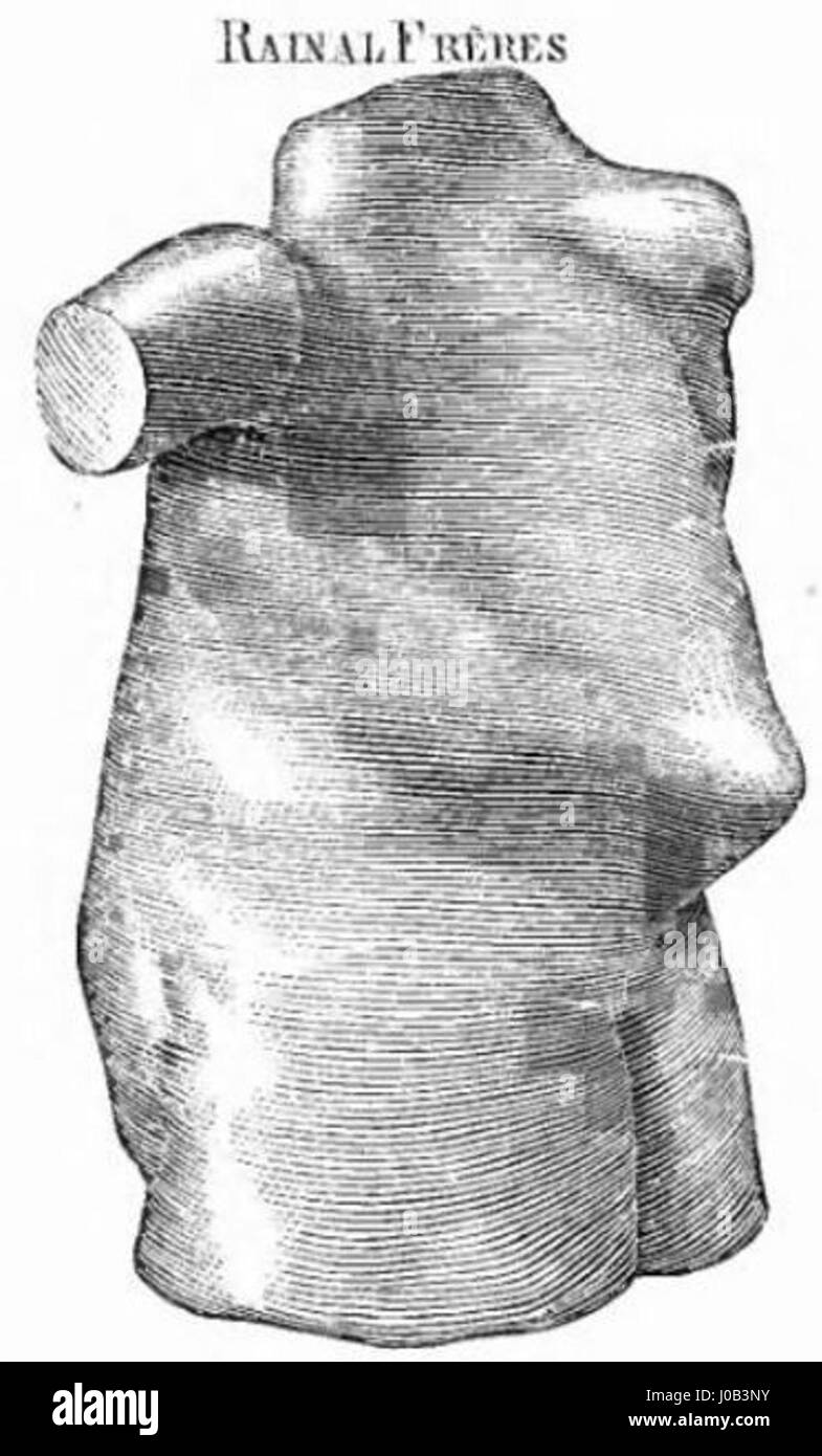 The 'Catalogue de corsets de Rainal Frères' is a historical catalog ...