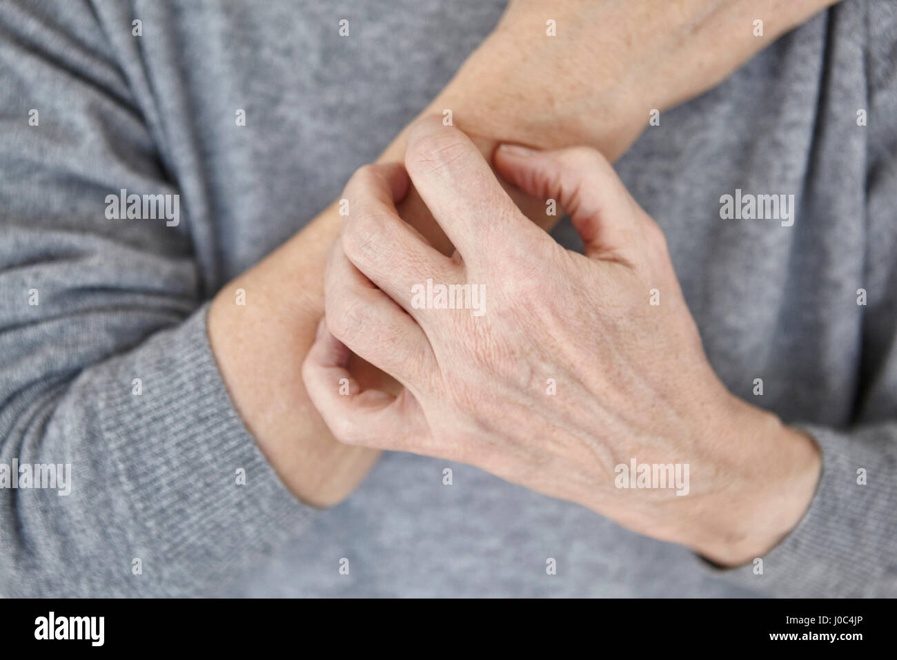 Senior woman scratching arm, close-up Stock Photo - Alamy