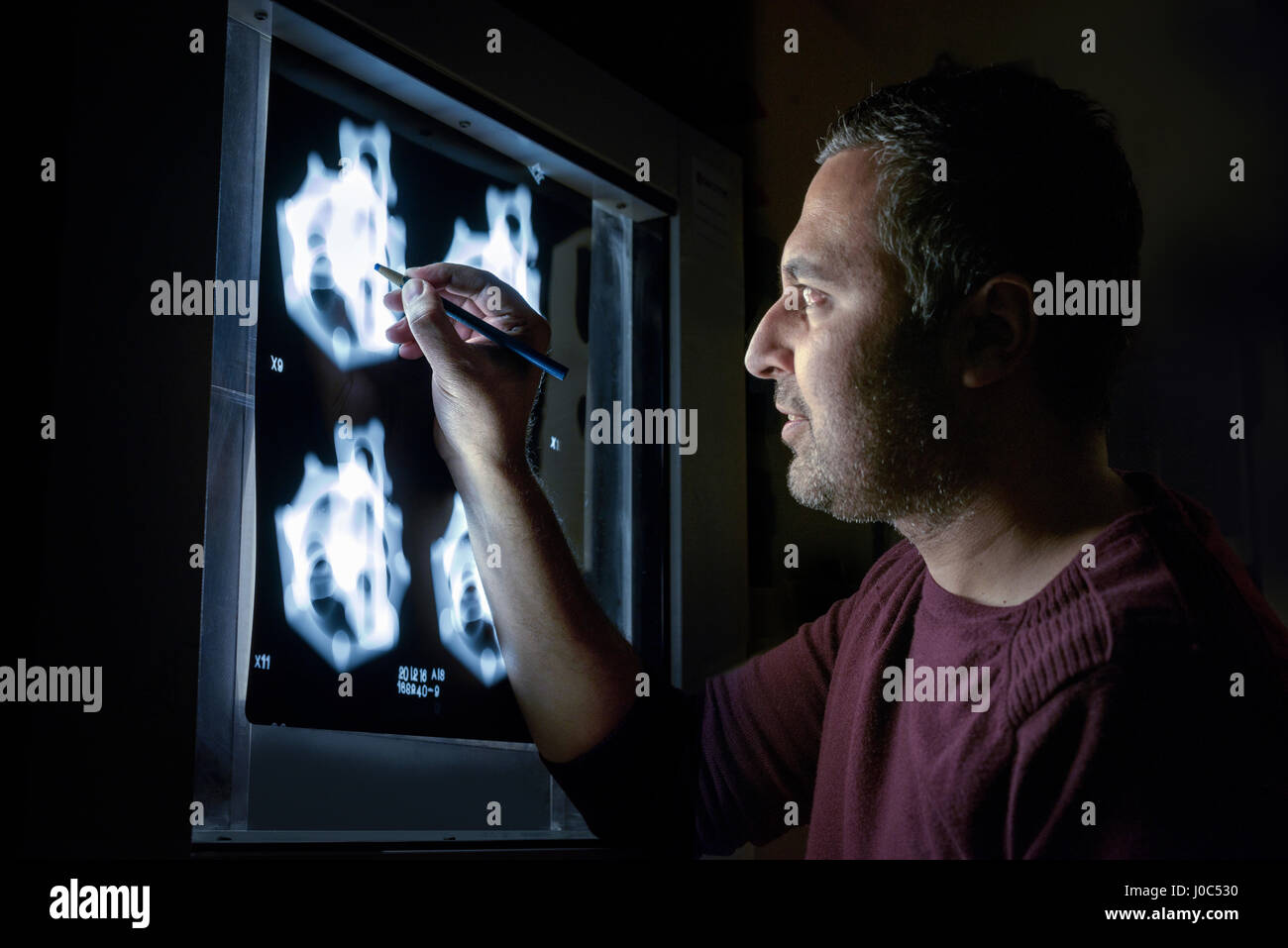 Xray x ray x ray High Resolution Stock Photography and Images - Alamy
