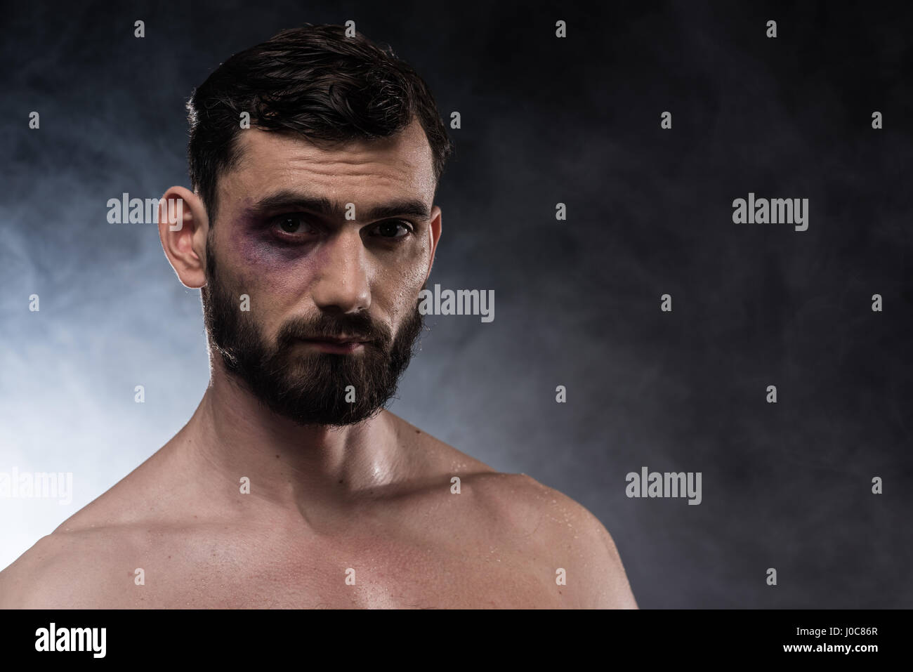 Bruised boxer hi-res stock photography and images - Alamy