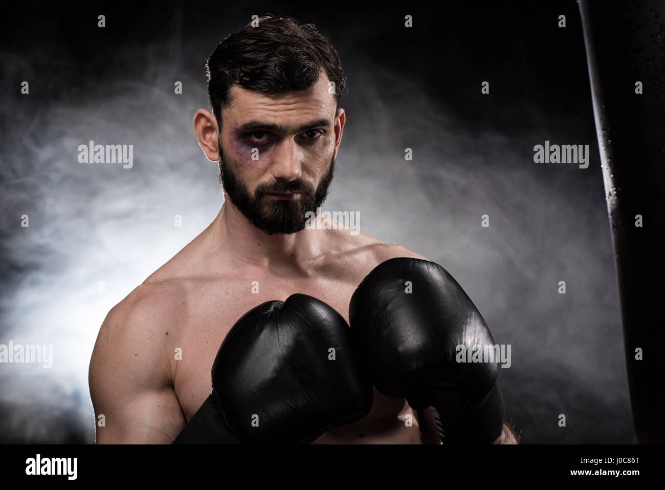 Professional young boxer with black eye looking at camera on black ...