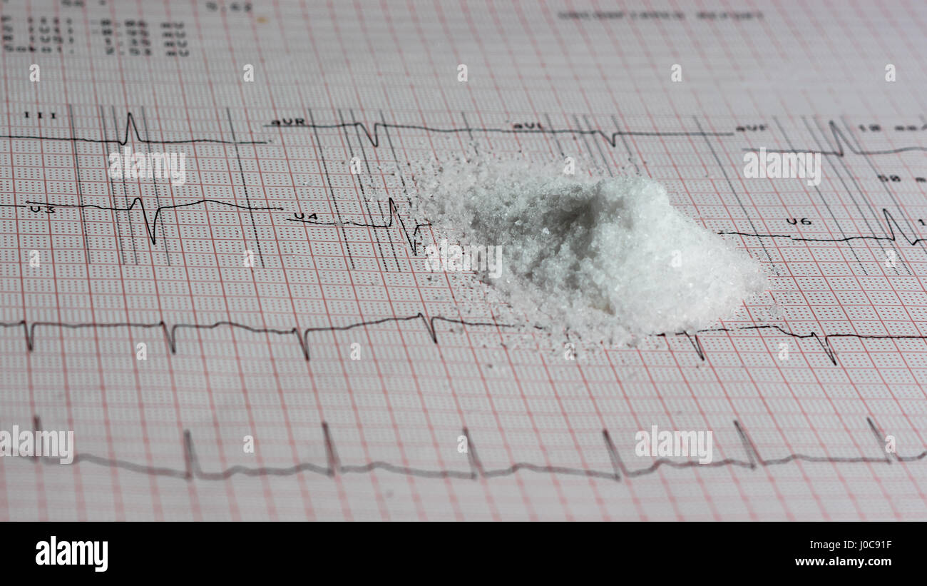 Pile of salt on an EKG test result - Electrocardiogram Stock Photo - Alamy