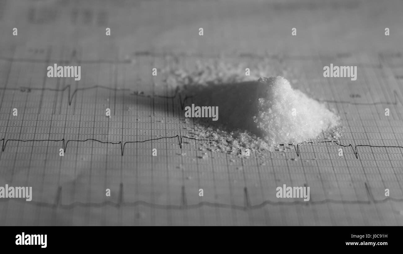 Pile of salt on an EKG test result - Electrocardiogram Stock Photo - Alamy