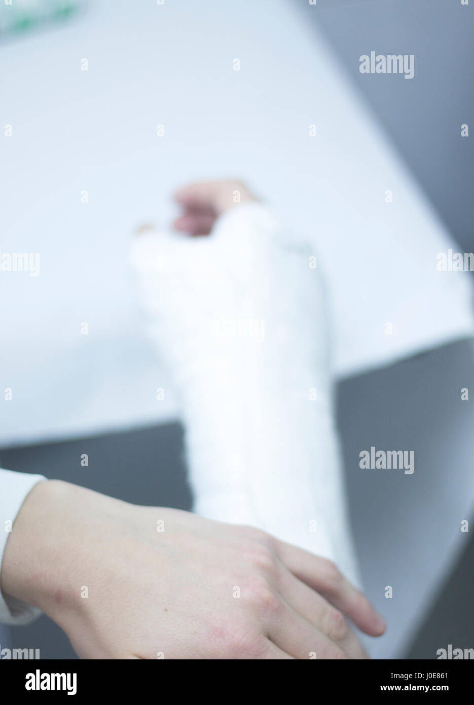 Doctor applying a plaster cast and bandages to patient forearm and ...